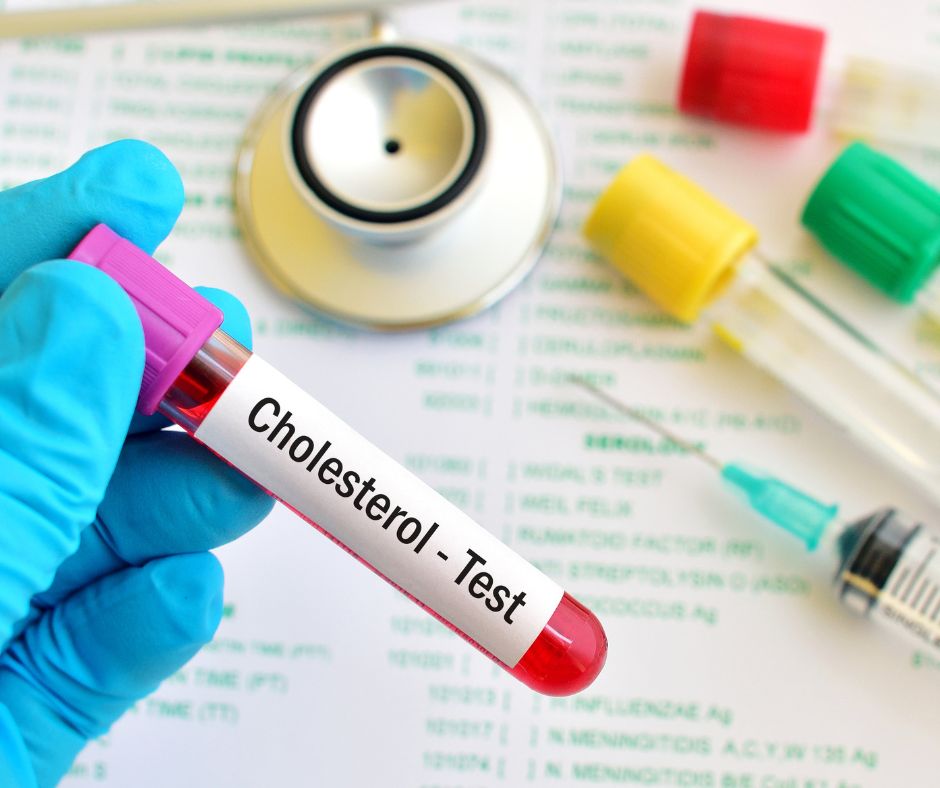What is a high cholesterol blood test? | Cholesterol, high cholesterol ...